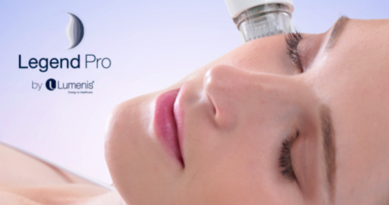 Lumenis Legend Pro™ – Midwest Skin Institute